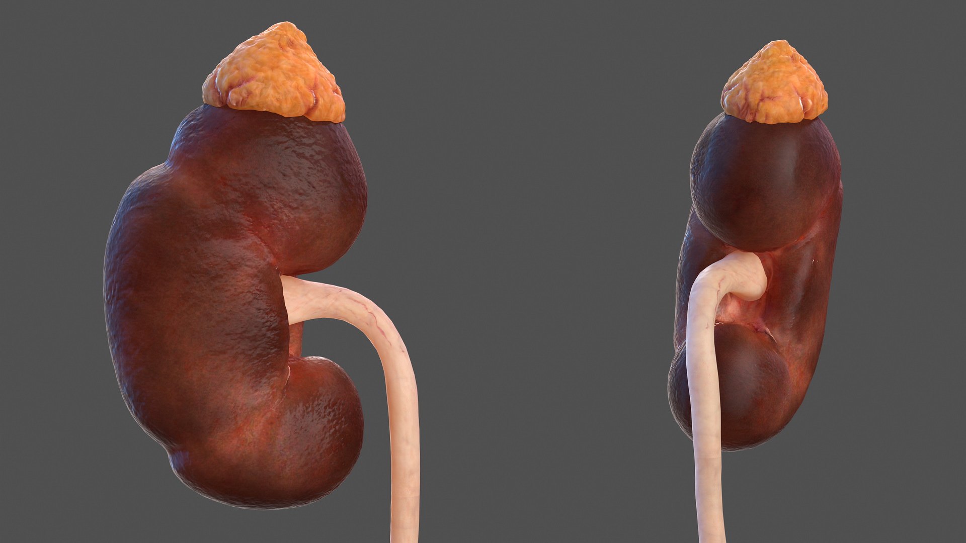 Human Kidney Adrenal Gland 3D Model - TurboSquid 1468297