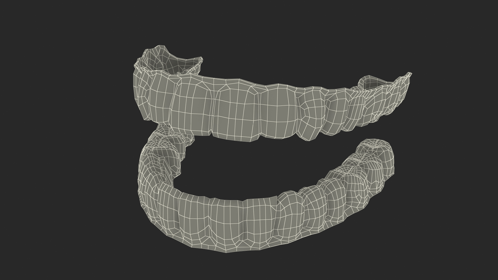 3D Teeth Replacement Retainer Model - TurboSquid 1824365