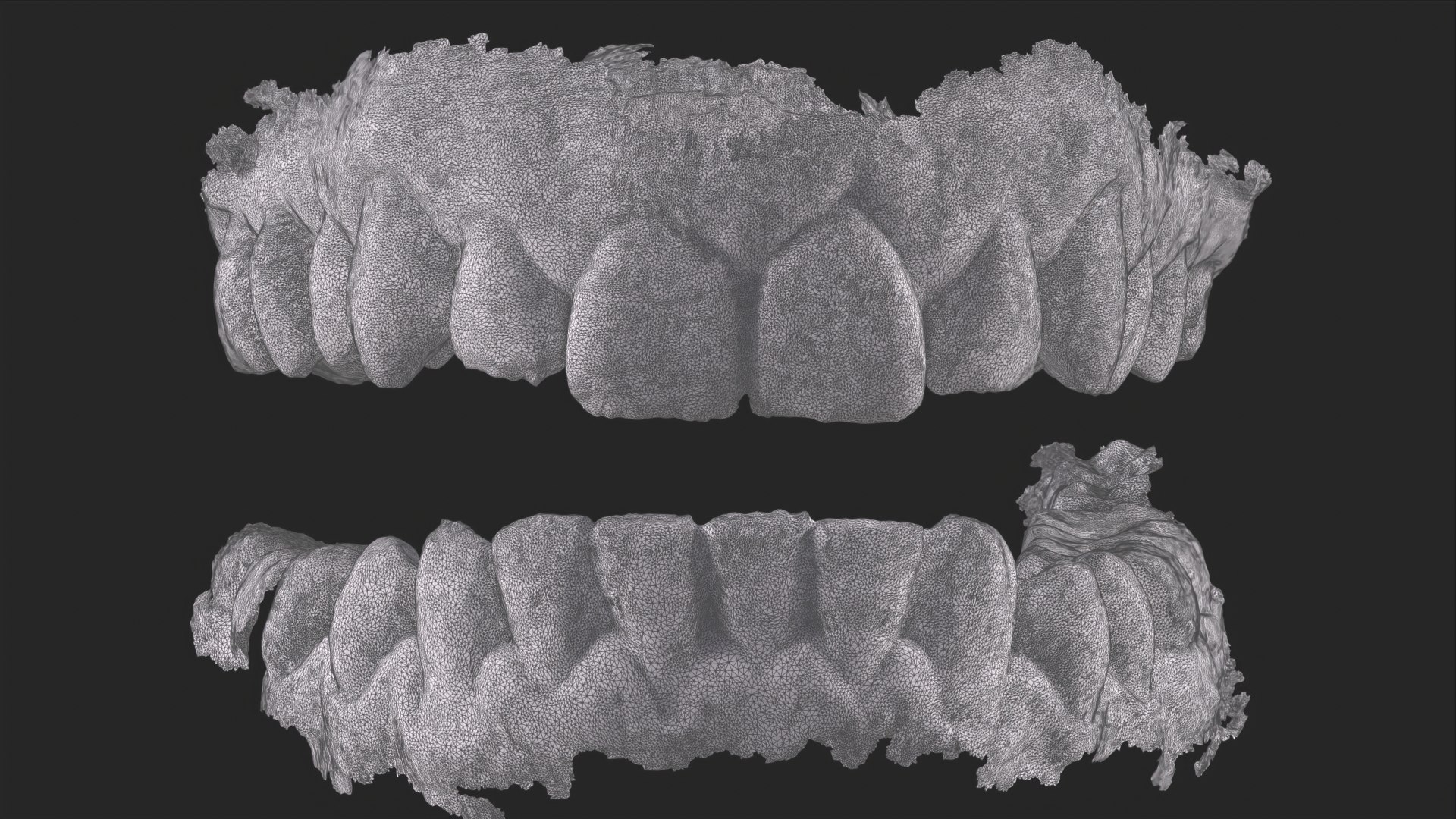 3D Dental Anatomy 3 Real Medical Cases Upper And Lower Jaw 3D Print ...