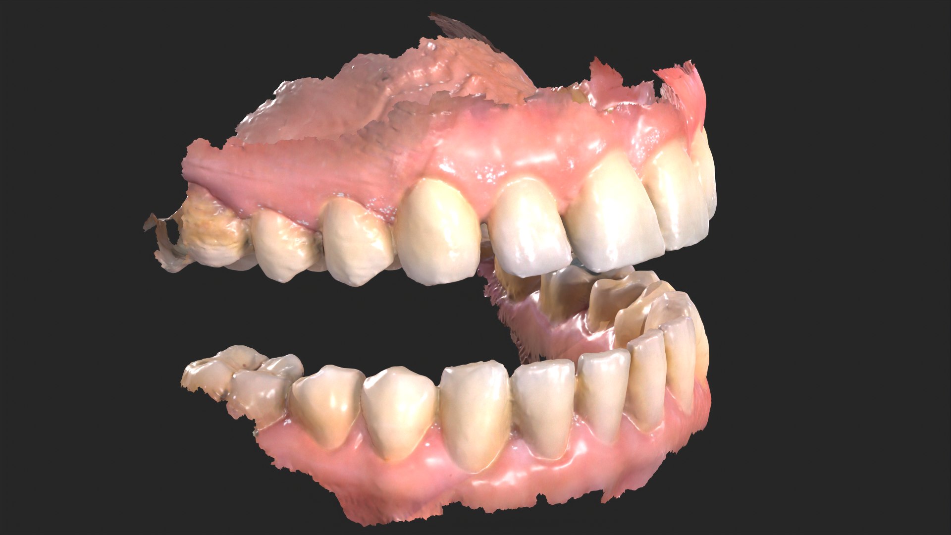 3D Dental Anatomy 3 Real Medical Cases Upper And Lower Jaw 3D Print ...
