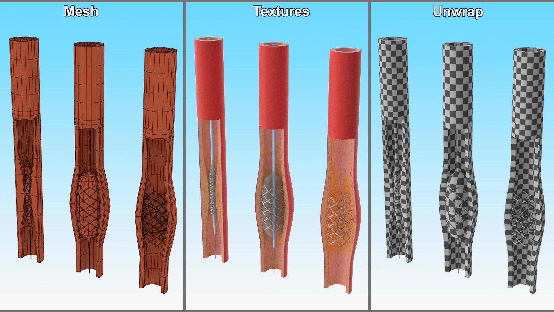 Stents With Artery 3D Model - TurboSquid 2239816