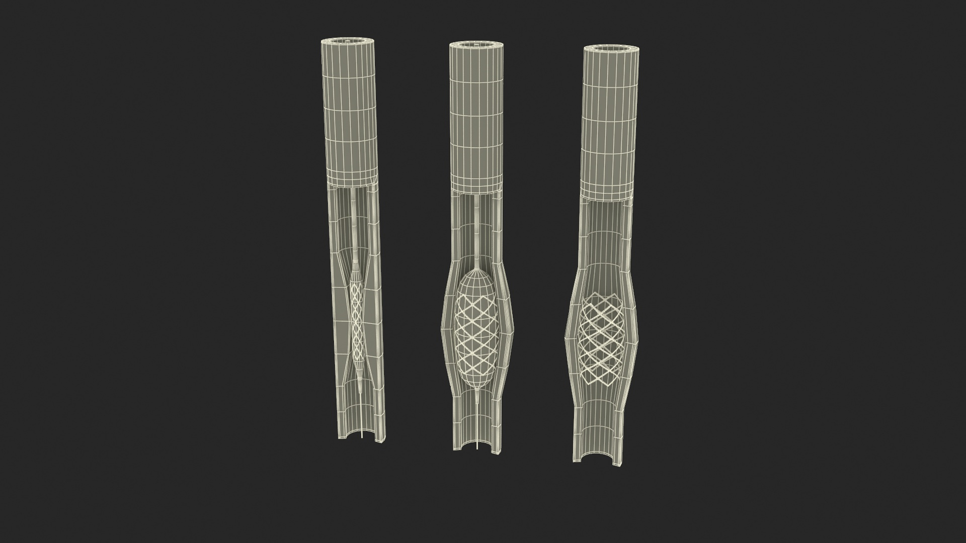 Stents With Artery 3D Model - TurboSquid 2239816