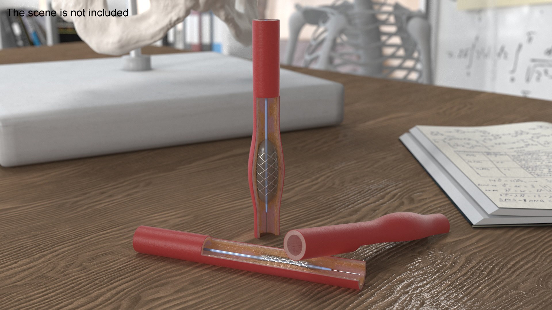 Stents With Artery 3D Model - TurboSquid 2239816
