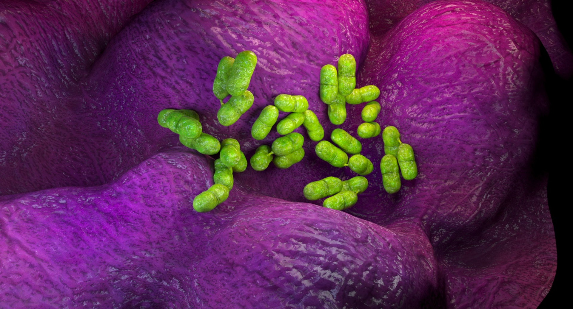 3D listeria - TurboSquid 1321227