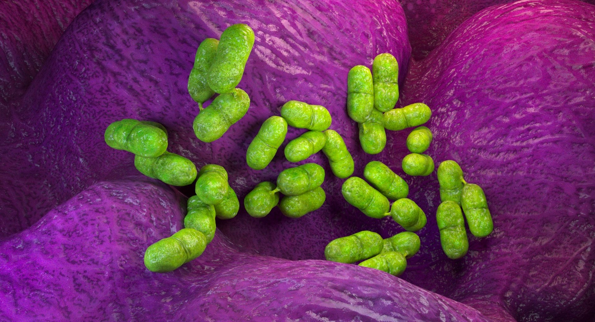 3D listeria - TurboSquid 1321227