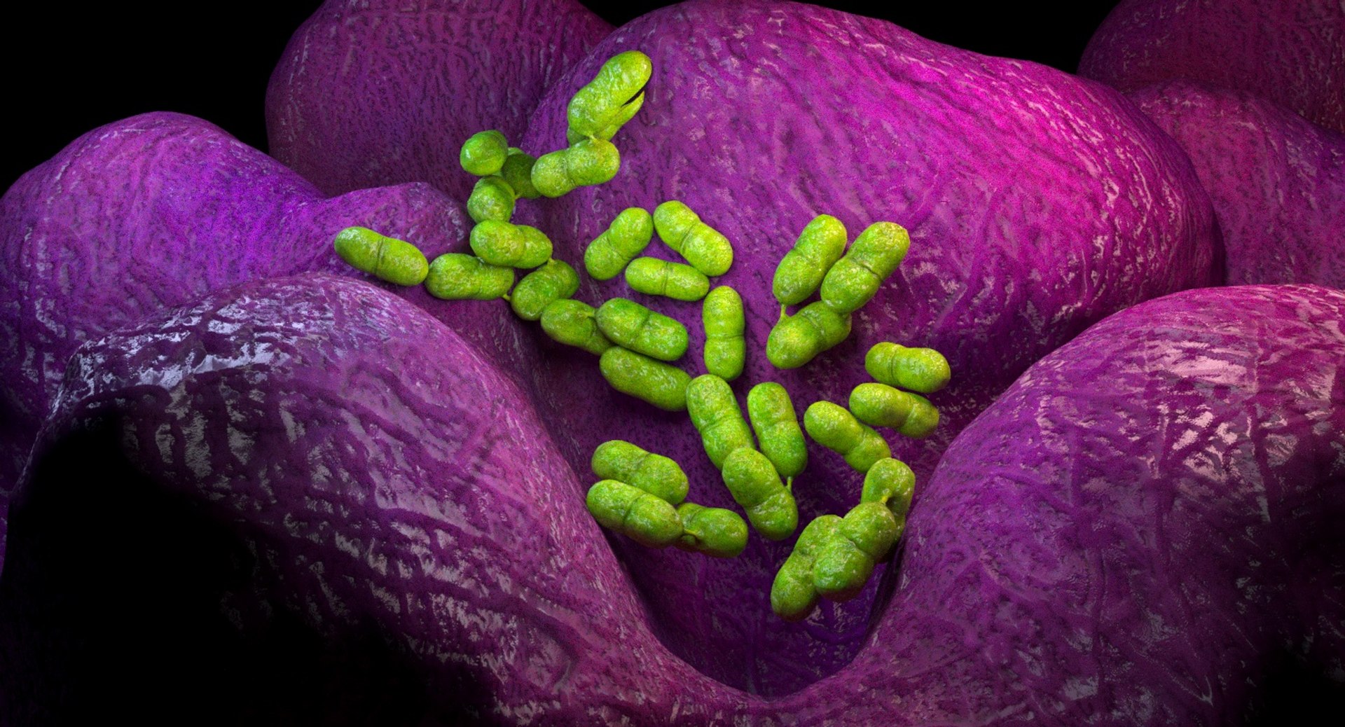 3D listeria - TurboSquid 1321227