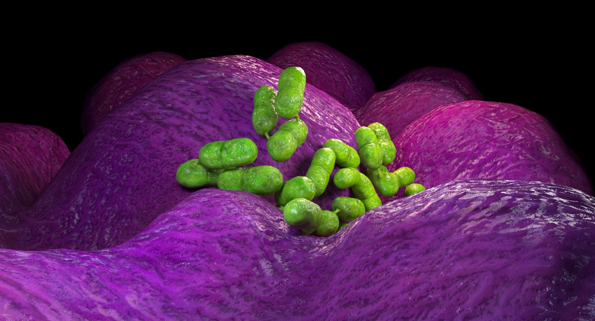 3D listeria - TurboSquid 1321227