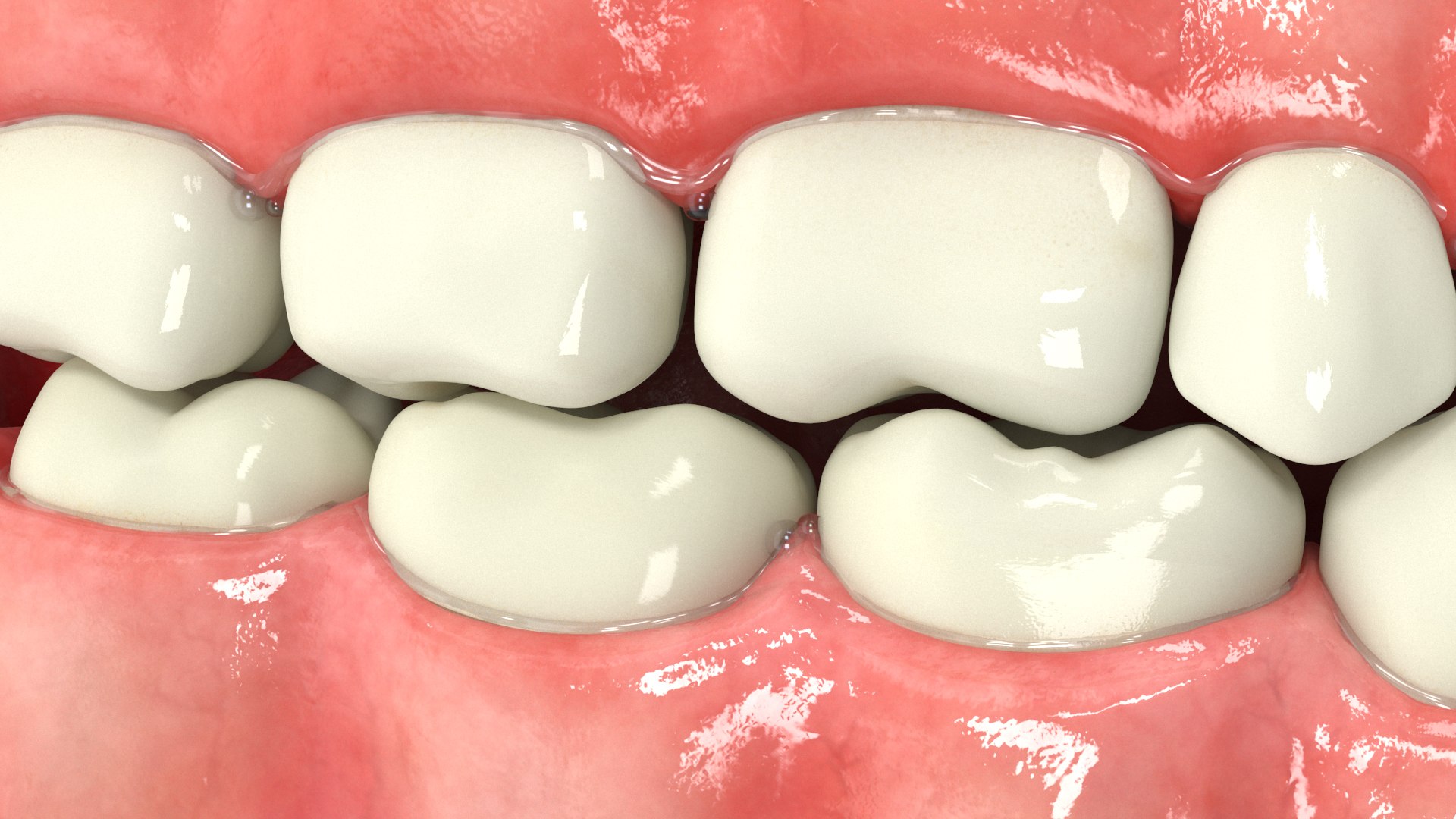 Realistic Human Mouth Rig 3ds MAX 3D model - TurboSquid 1916012