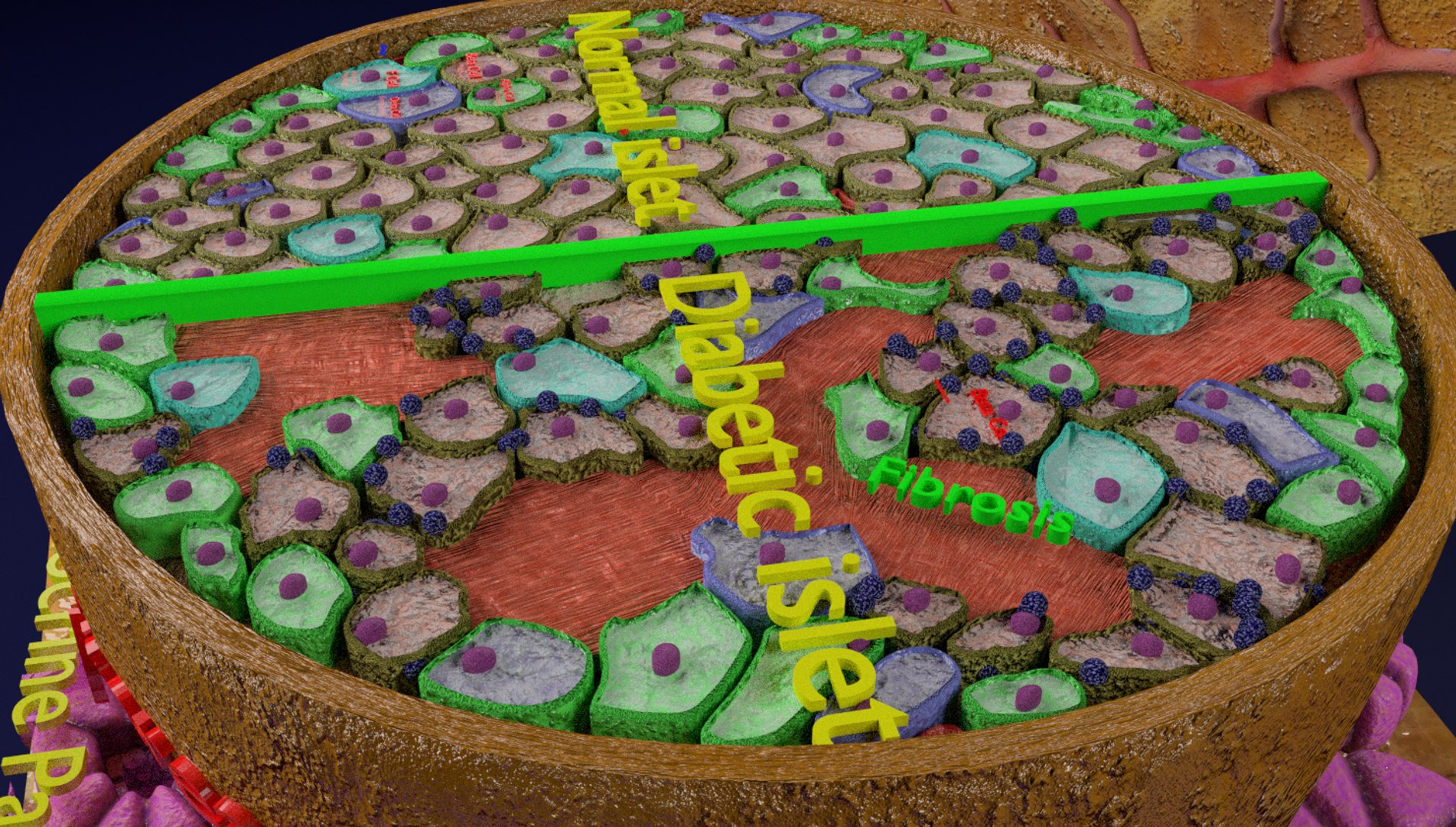 Pancreas diabetes anatomy islets model - TurboSquid 1409362