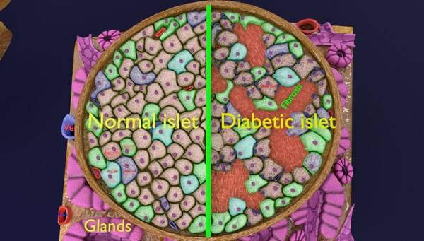 modelo 3d Diabetes Páncreas Anatomía Microscopía Isleta Beta Insulina ...