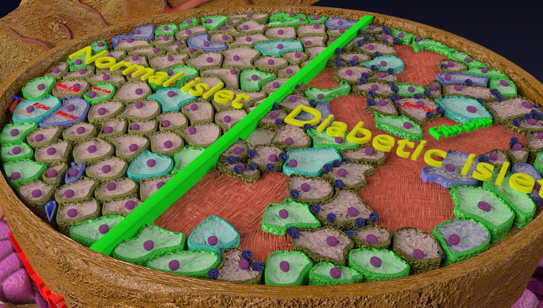 Pancreas diabetes anatomy islets model - TurboSquid 1409362