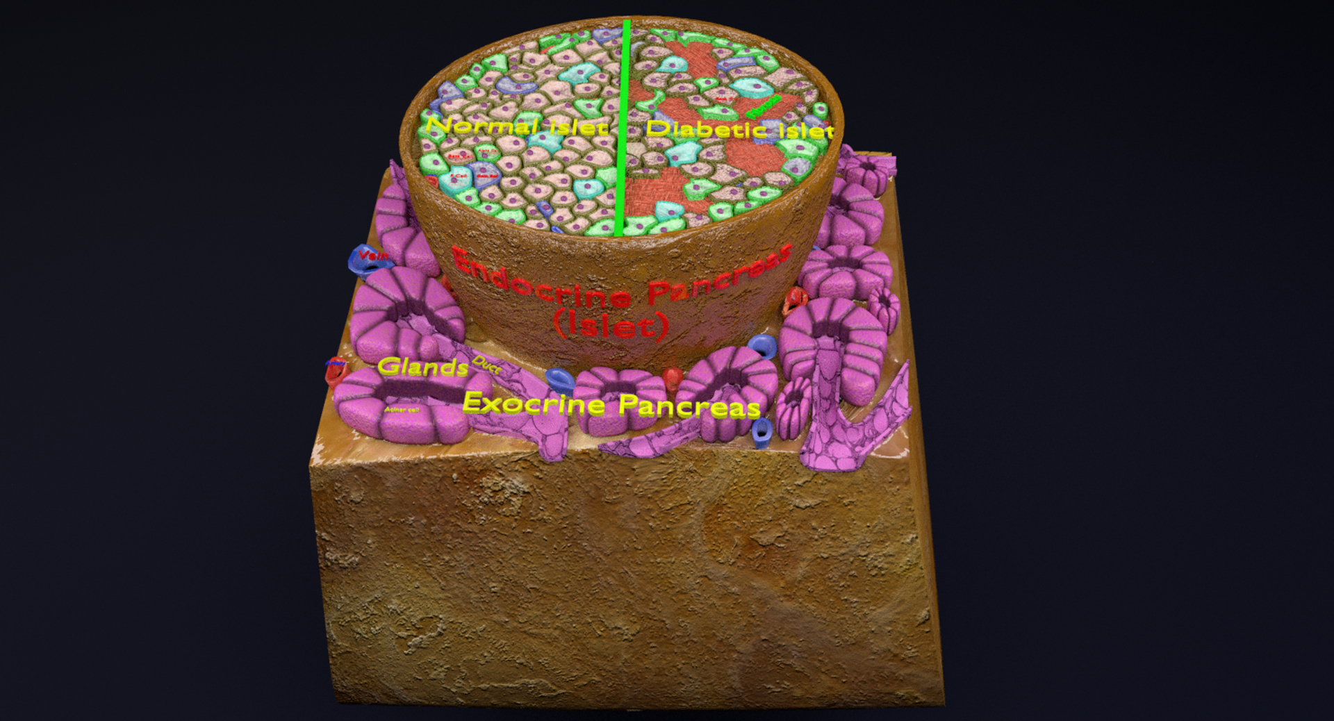 Pancreas diabetes anatomy islets model - TurboSquid 1409362