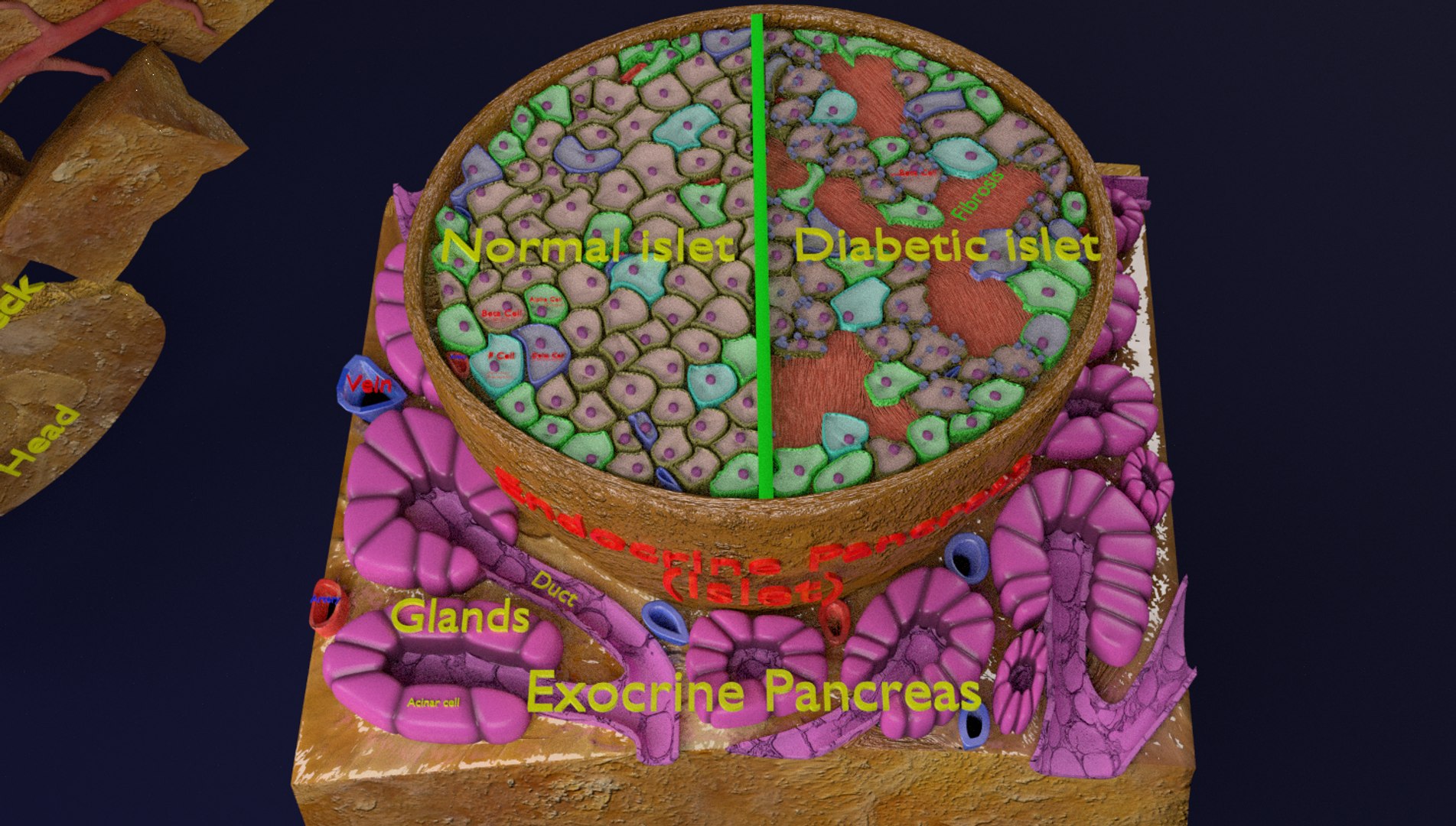 Pancreas Diabetes Anatomy Islets Model - TurboSquid 1409362