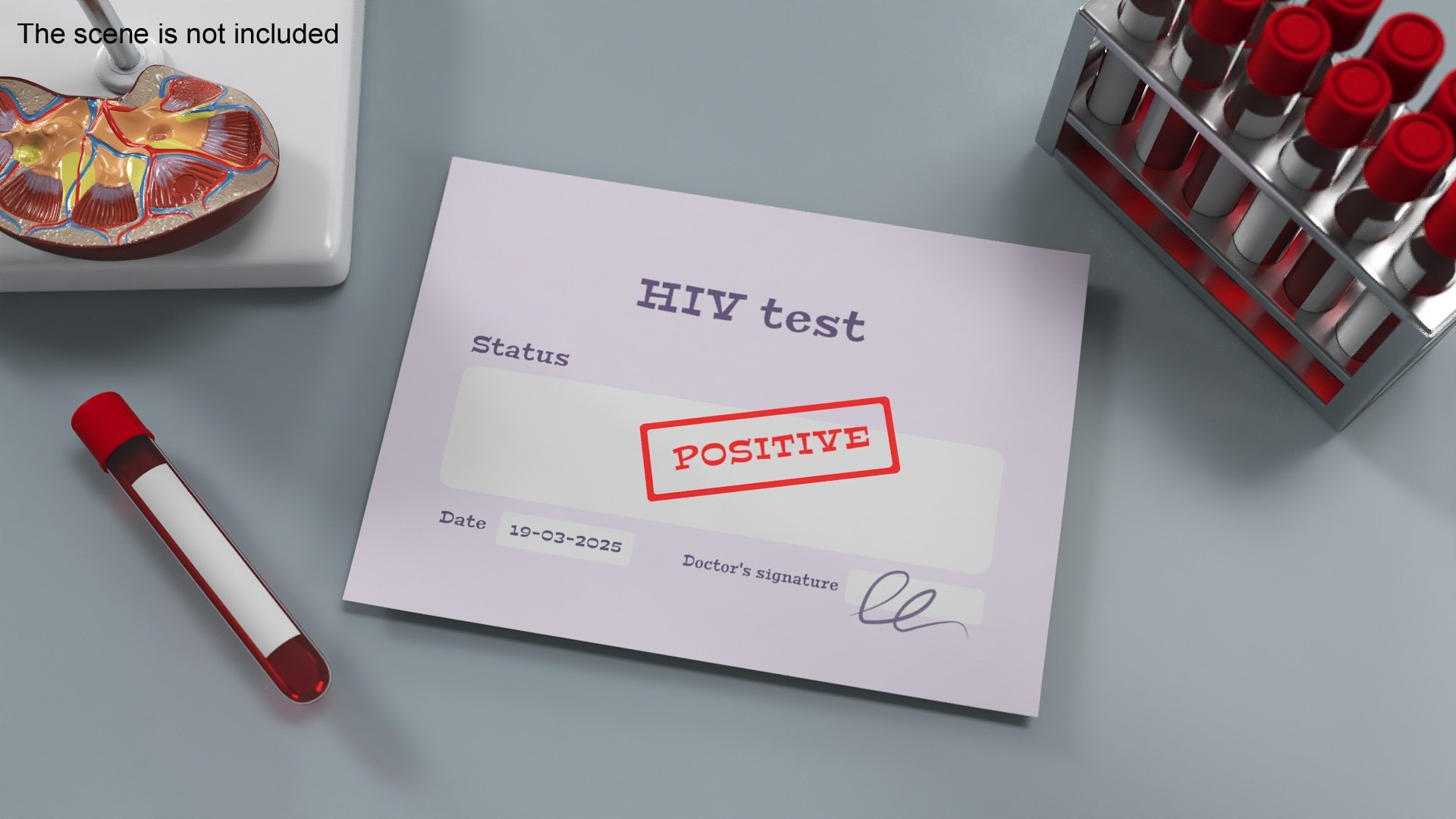 HIV Rapid Test Card Positive 3D Model - TurboSquid 2395933
