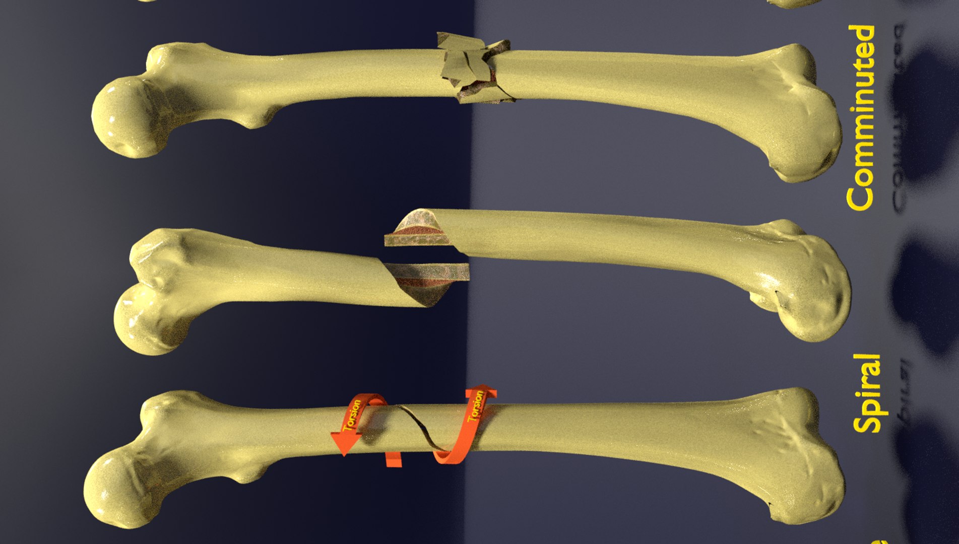 3D Model Types Fractures - TurboSquid 1480748