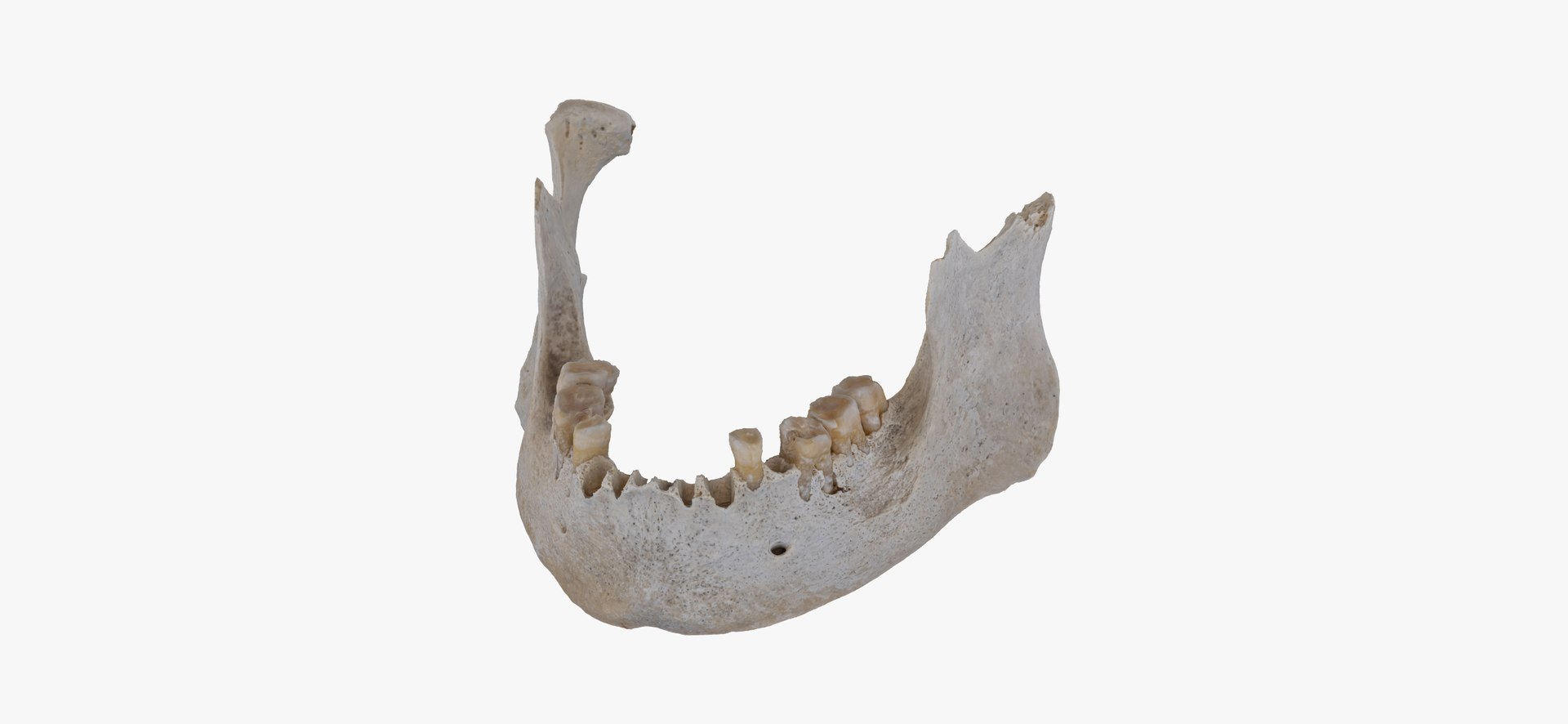 3D Model Real Human Female Jawbone Mandible 03 RAW Scan - TurboSquid ...