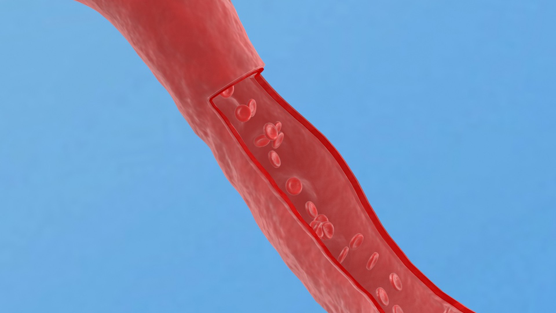 3D Model Blood Vesselsby Medical Premium - TurboSquid 1862501