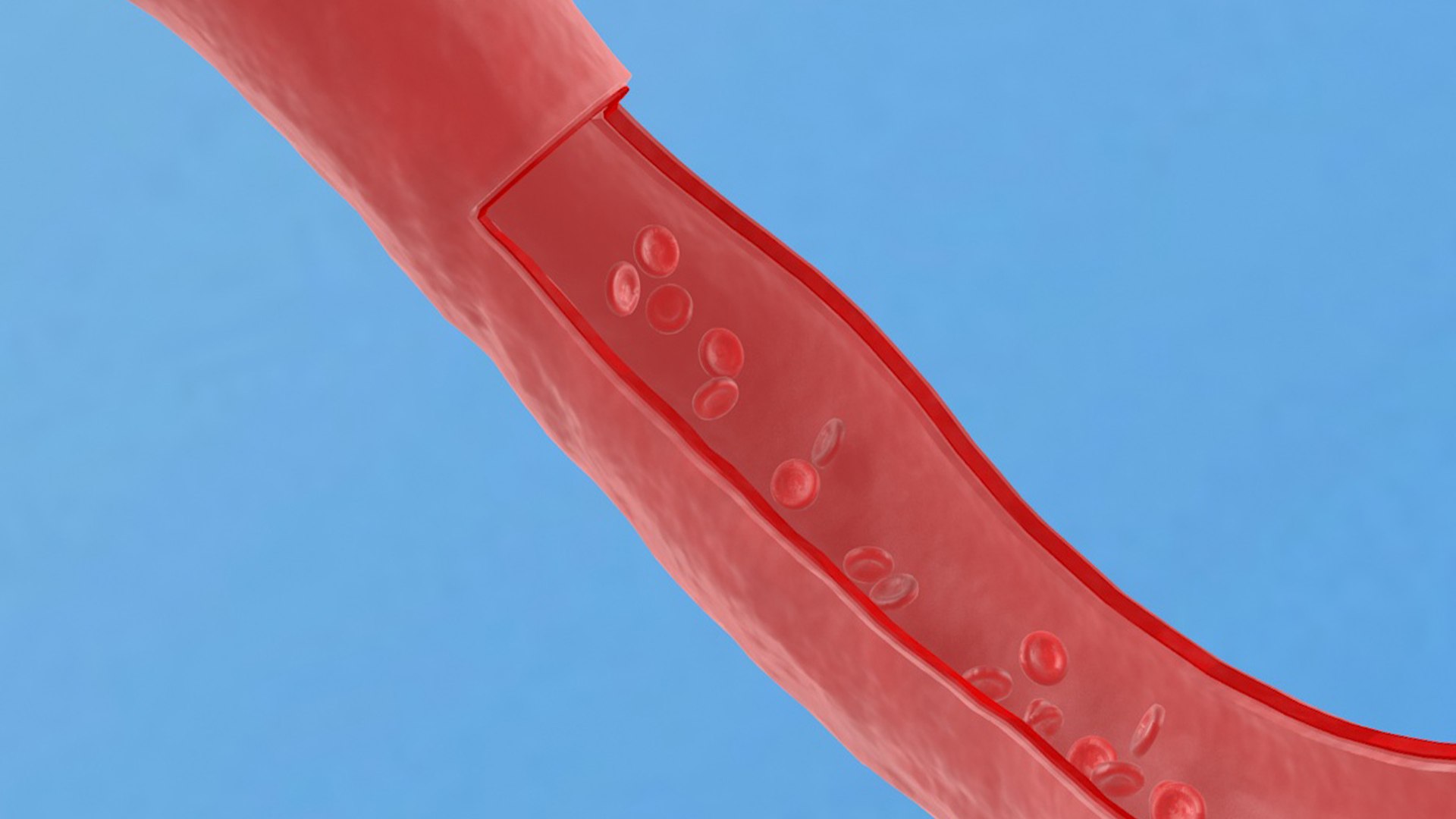 3D Model Blood Vesselsby Medical Premium - TurboSquid 1862501