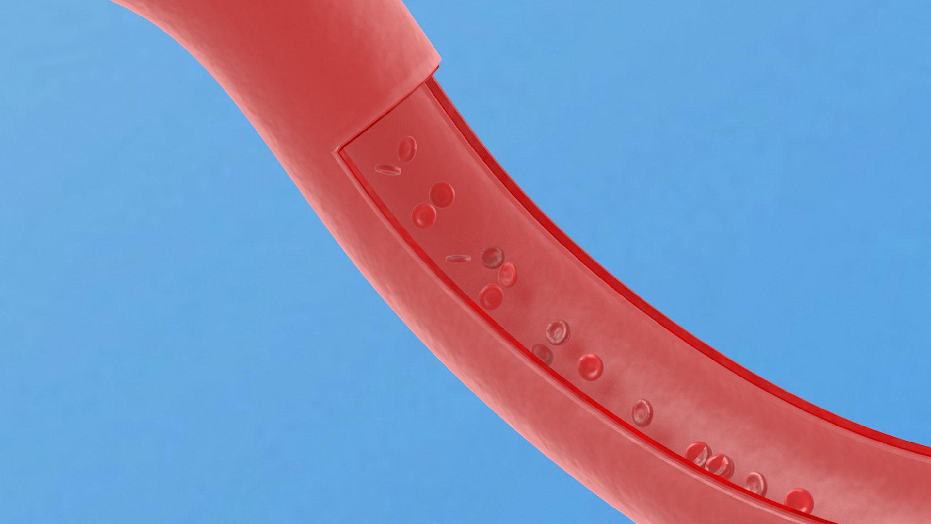 3D Model Blood Vesselsby Medical Premium - TurboSquid 1862501