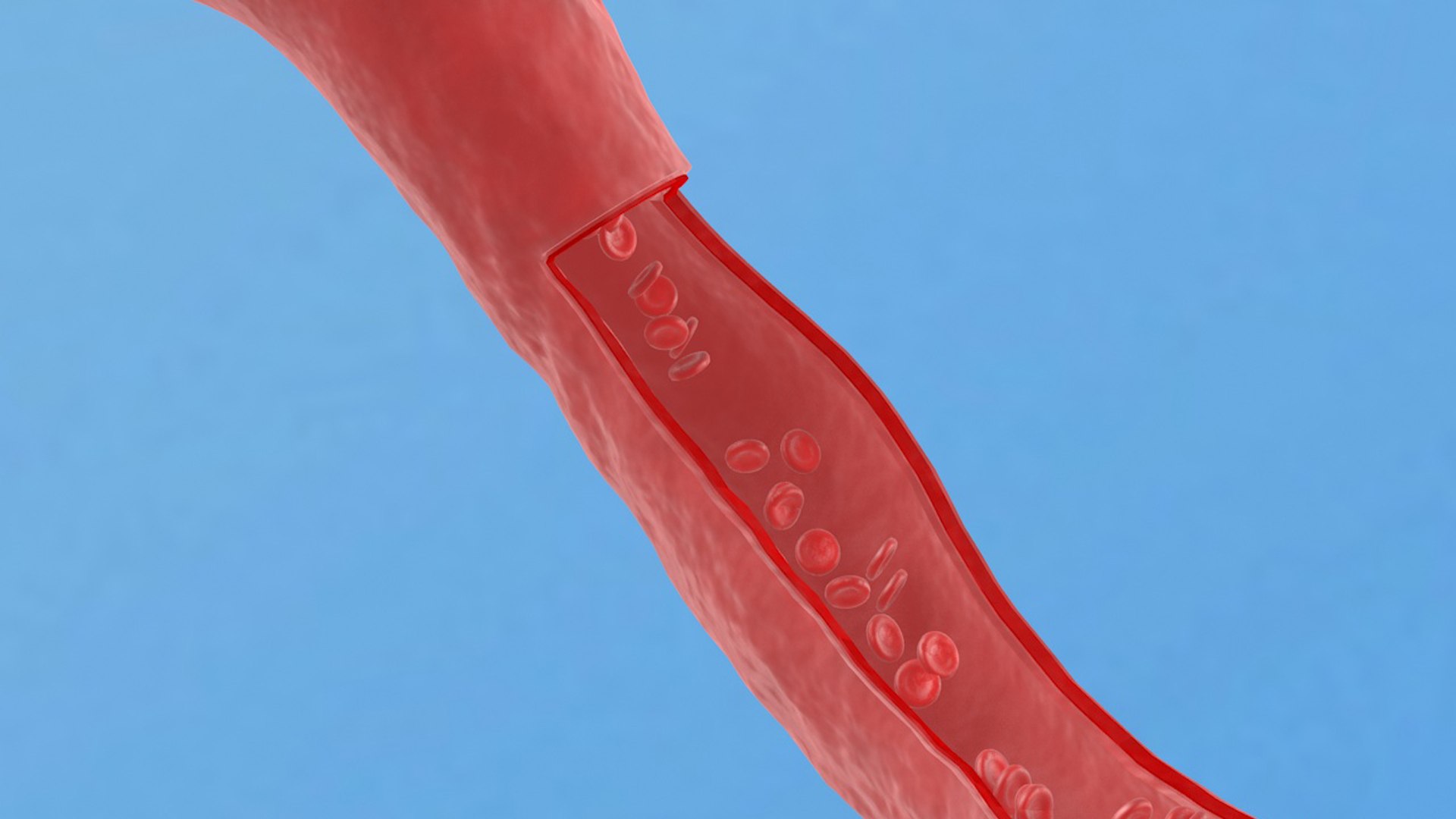 3D Model Blood Vesselsby Medical Premium - TurboSquid 1862501