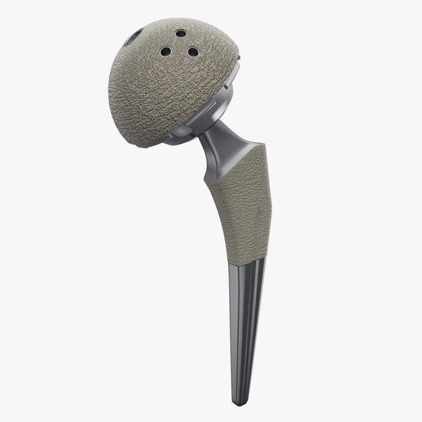 femoral prosthesis 3d model