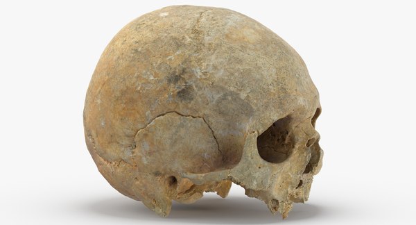 modelo 3d Cráneo humano real con lepra 01 - TurboSquid 1537597