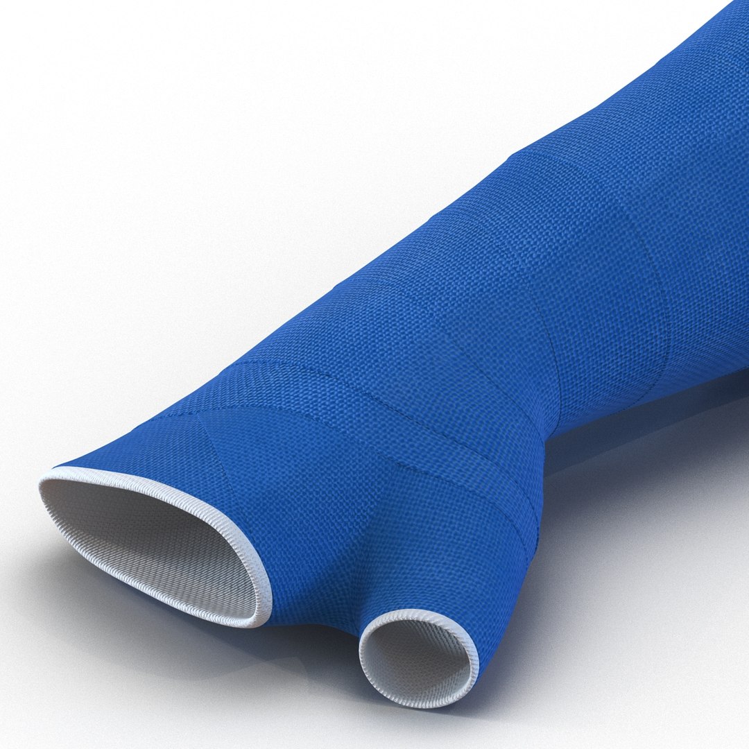 3d Model Blue Fiberglass Cast Arm
