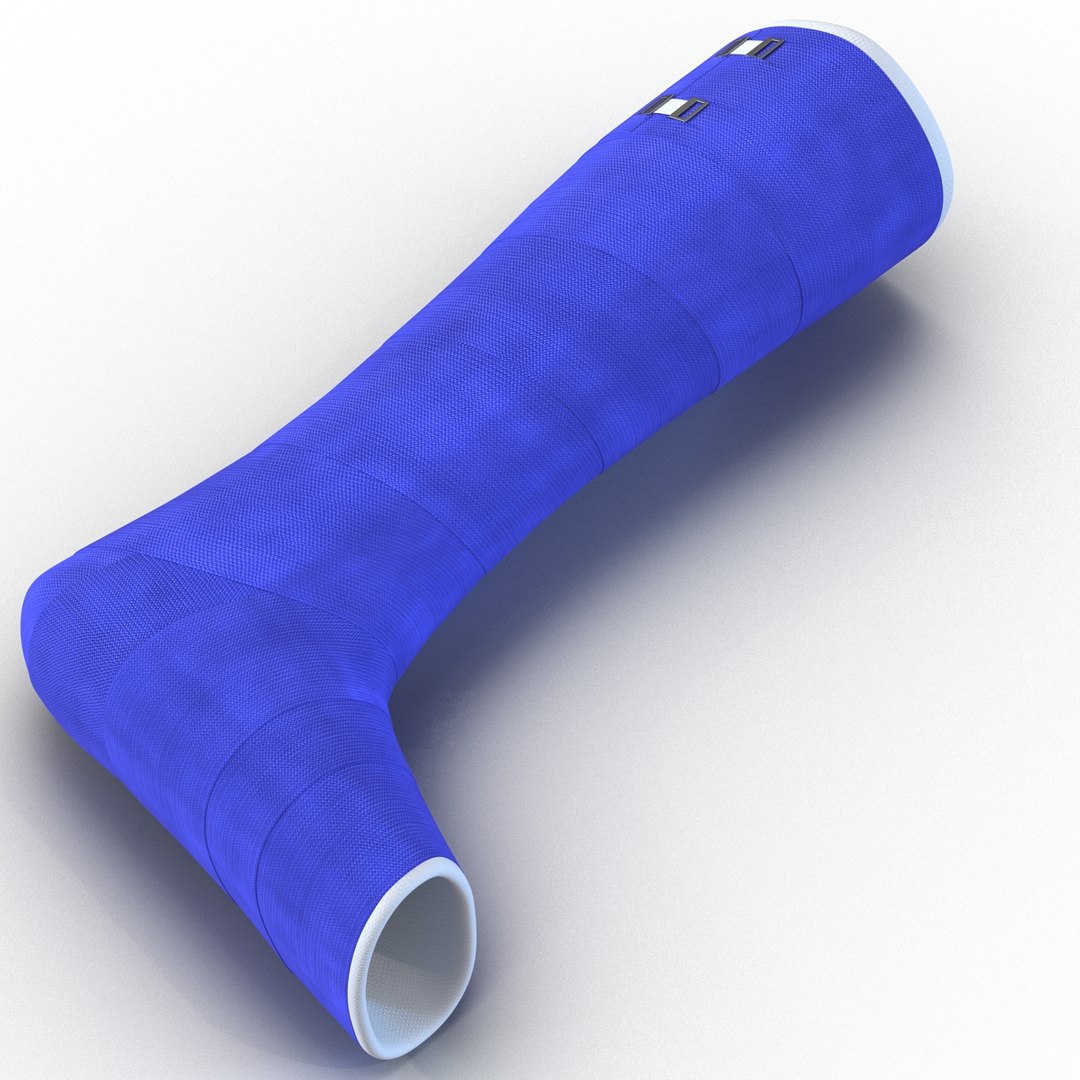 3d model blue fiberglass cast arm