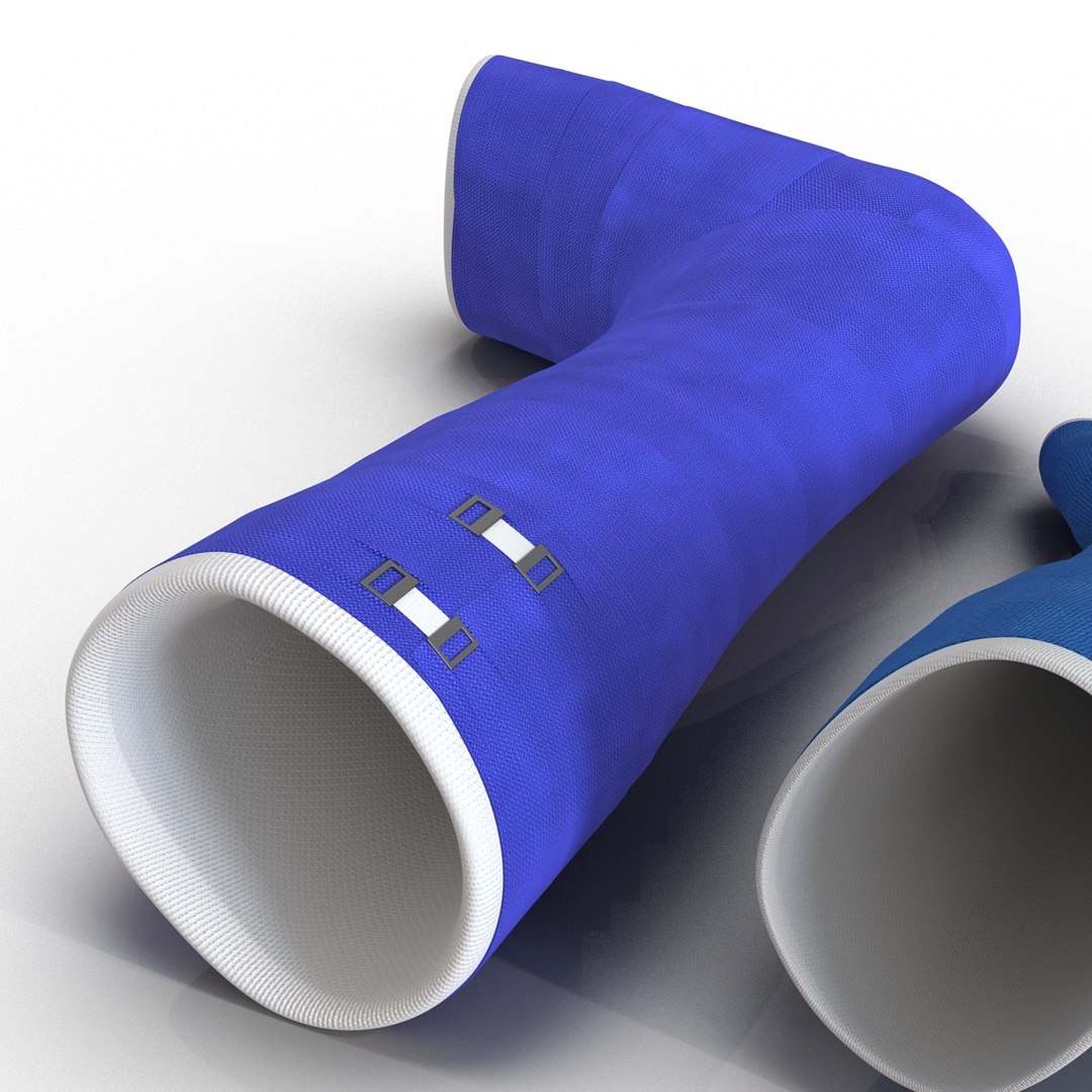 3d model blue fiberglass cast arm