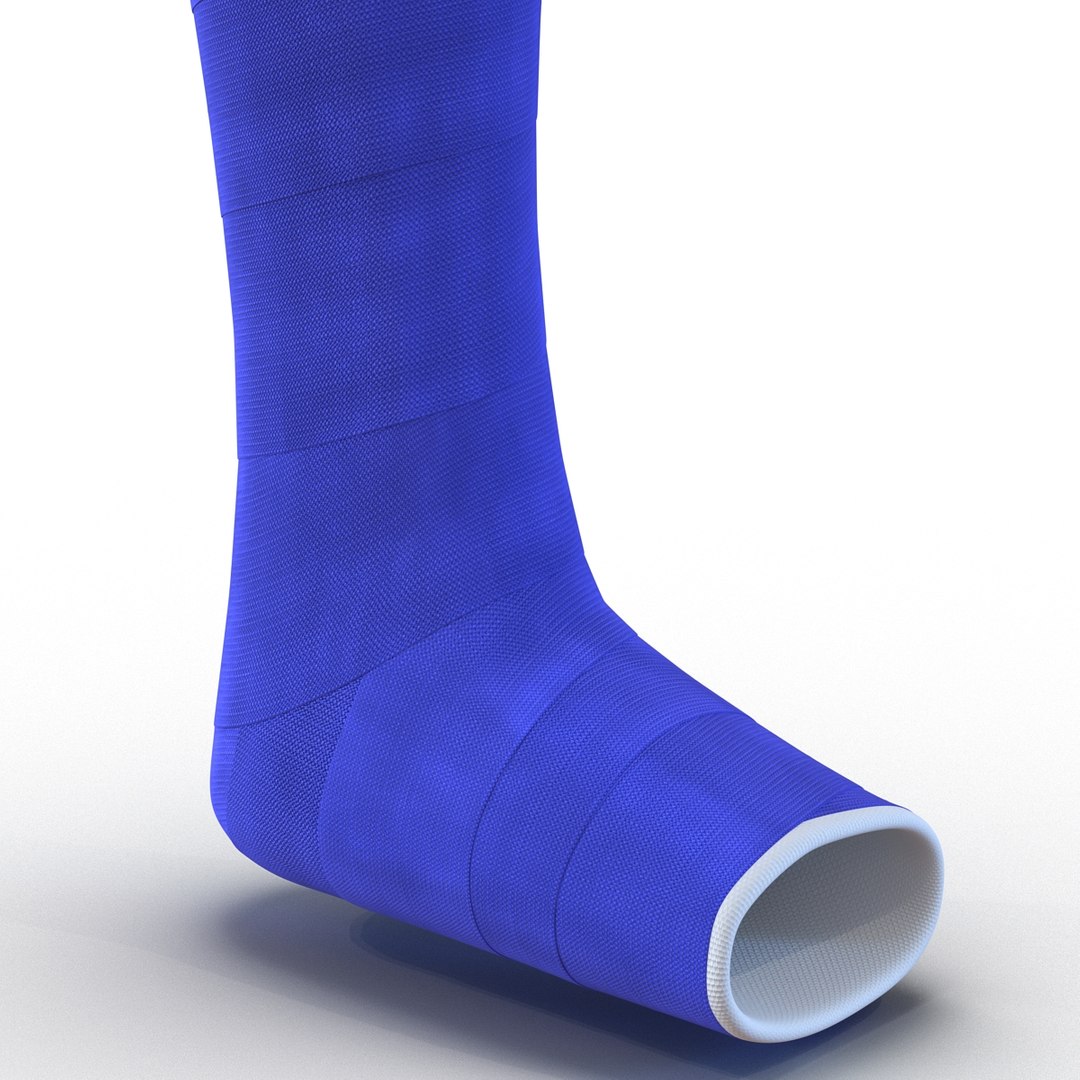 3d model blue fiberglass cast arm