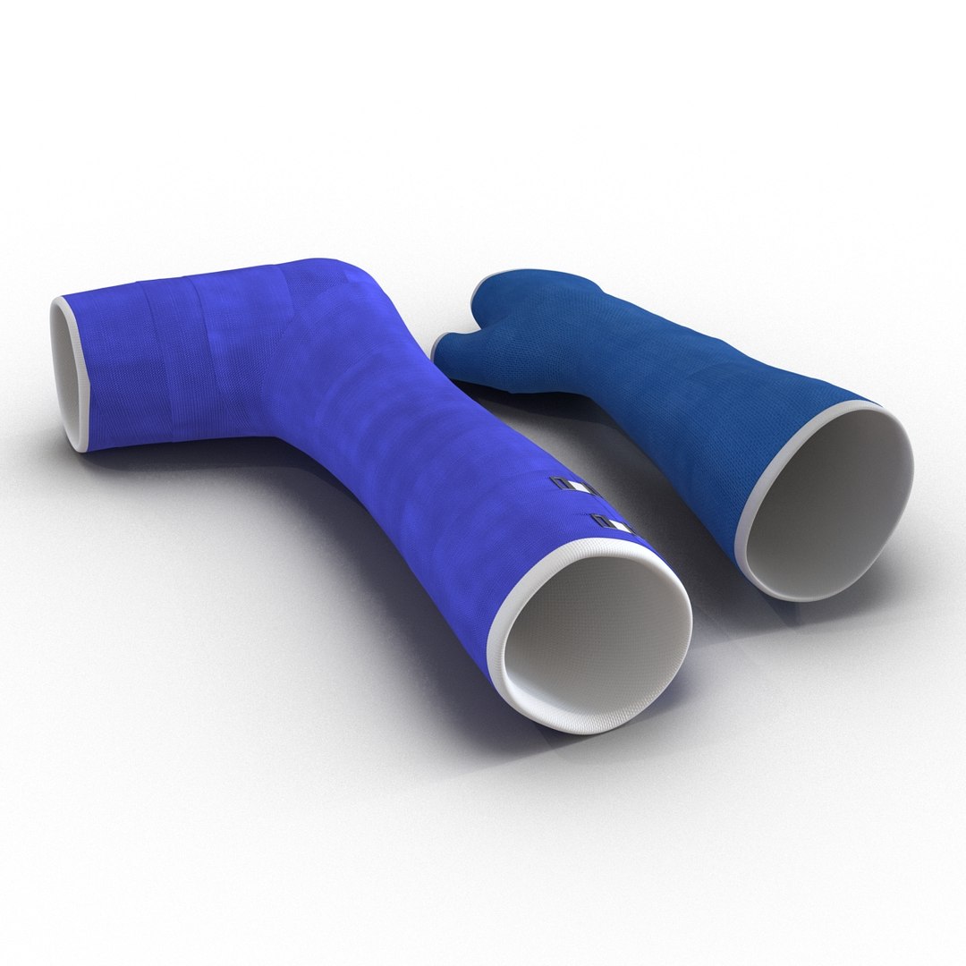 3d model blue fiberglass cast arm