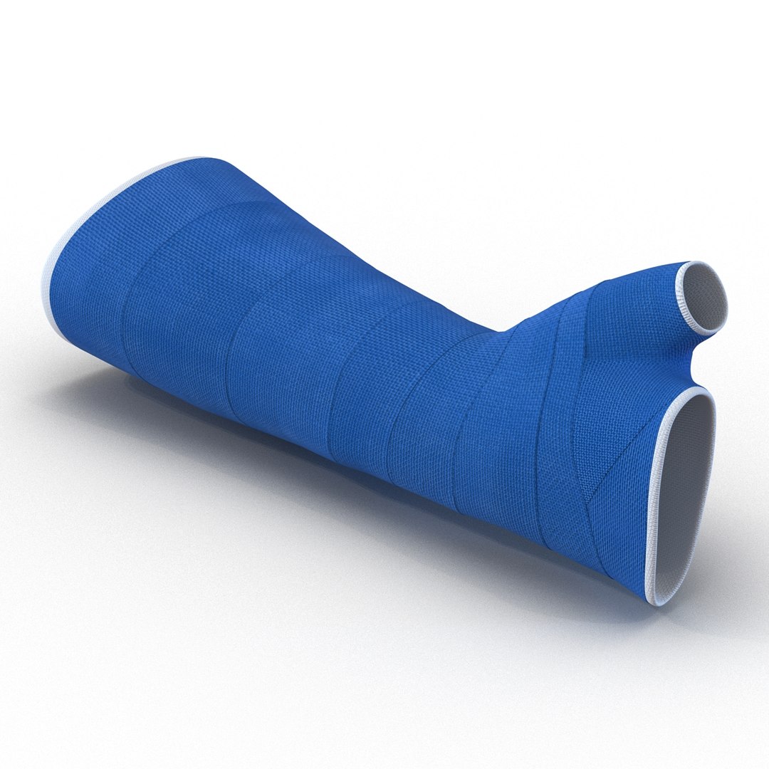 3d model blue fiberglass cast arm