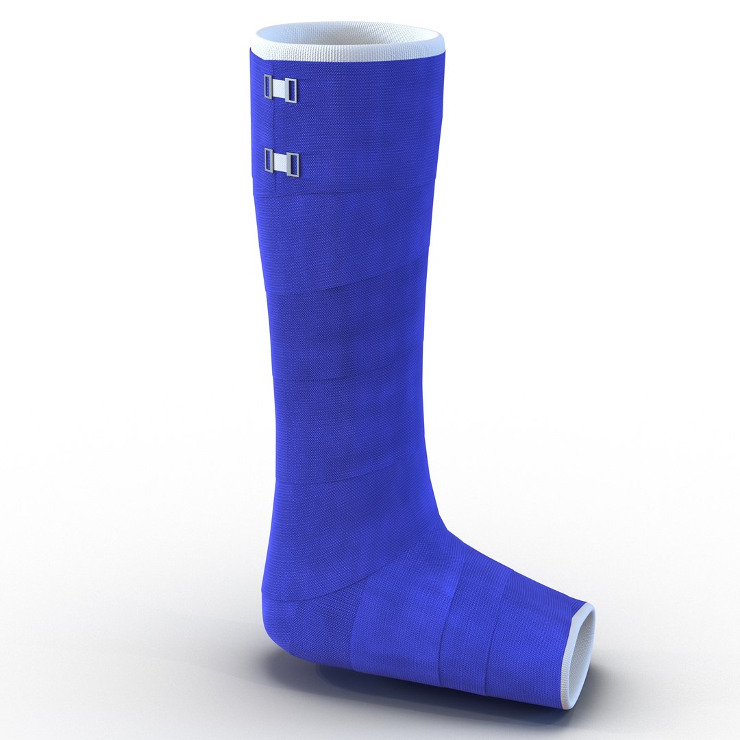 3d Model Blue Fiberglass Cast Arm