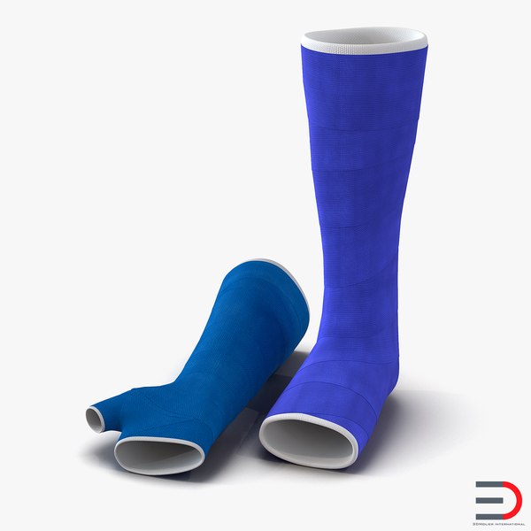 3d blue fiberglass cast arm