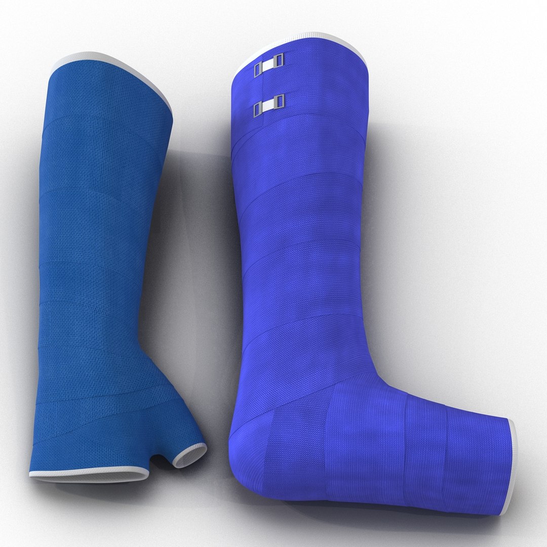 3d model blue fiberglass cast arm