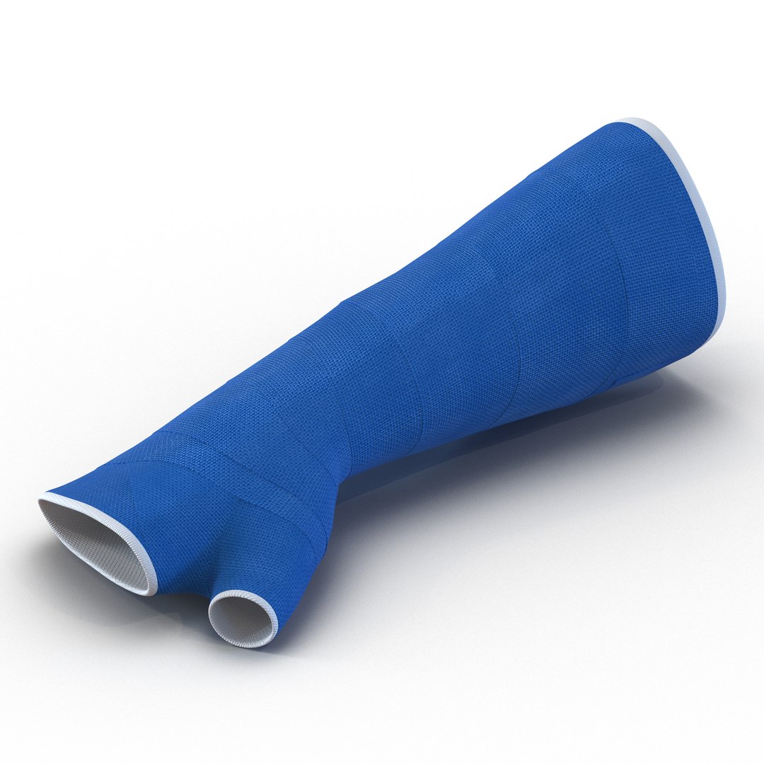 3d model blue fiberglass cast arm