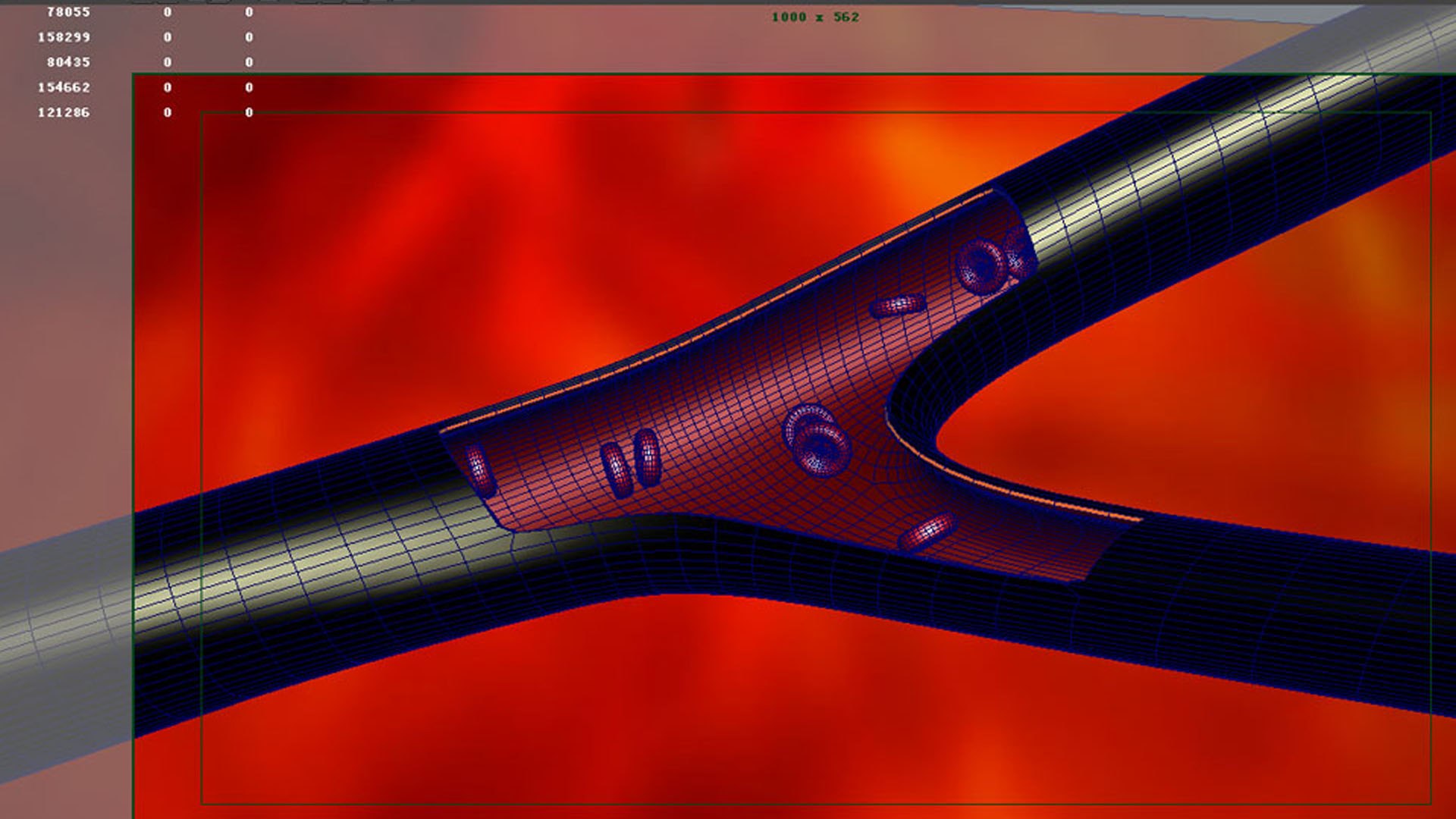 Artery Vein Clog Clot Clogged Stream Bloodflow Layers Section Anatomy ...