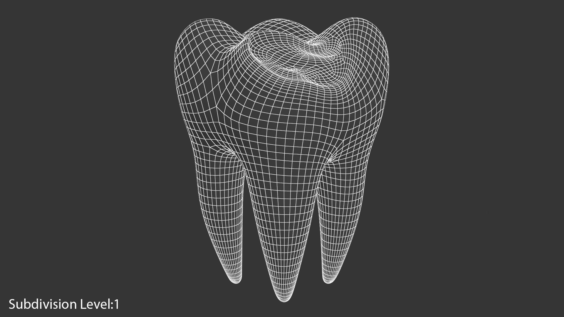 Teeth Decay 3D Model - TurboSquid 1438132
