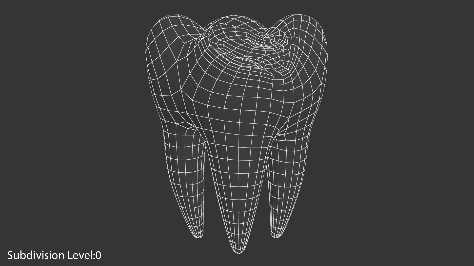 Teeth Decay 3D Model - TurboSquid 1438132