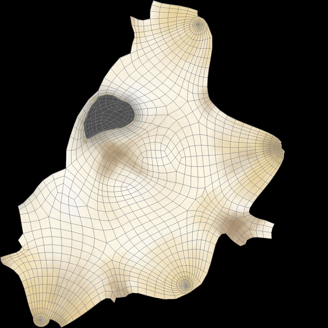 Teeth Decay 3D Model - TurboSquid 1438132