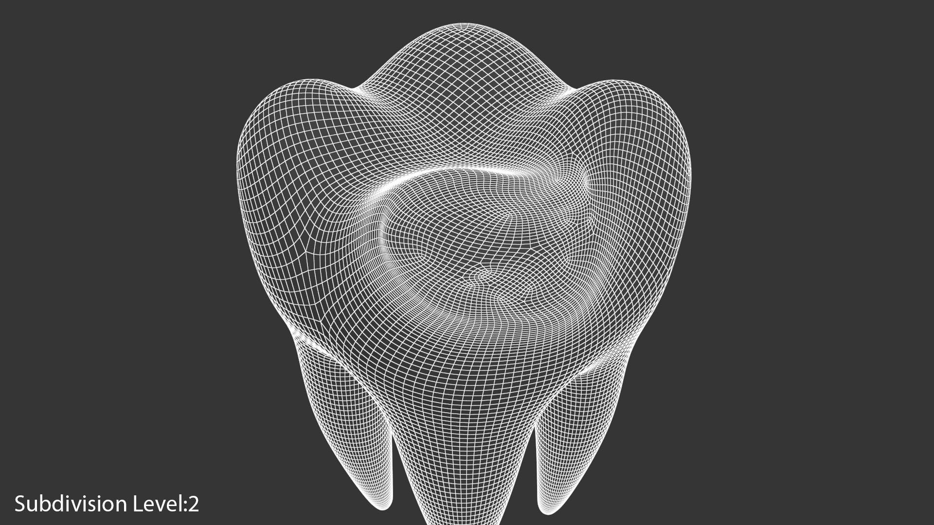 Teeth Decay 3D Model - TurboSquid 1438132