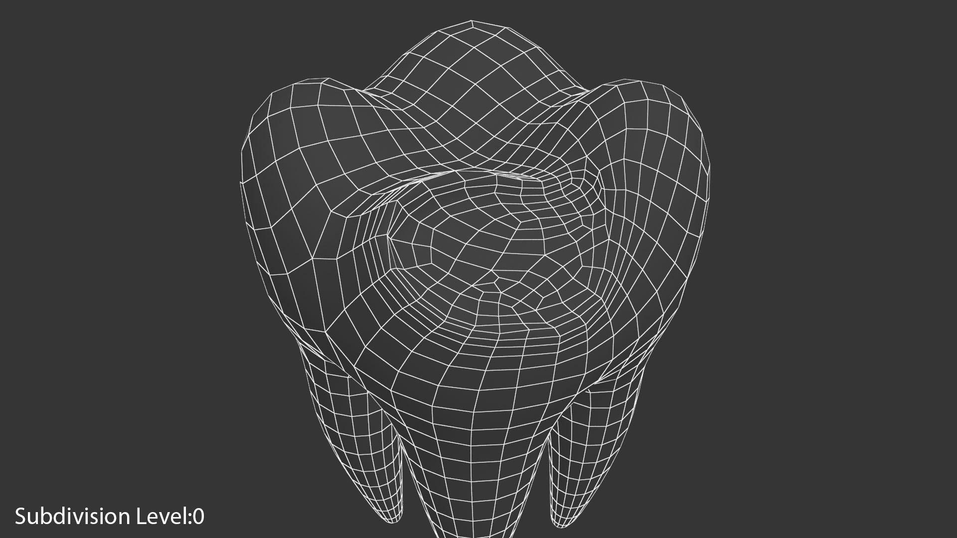 Teeth Decay 3D Model - TurboSquid 1438132