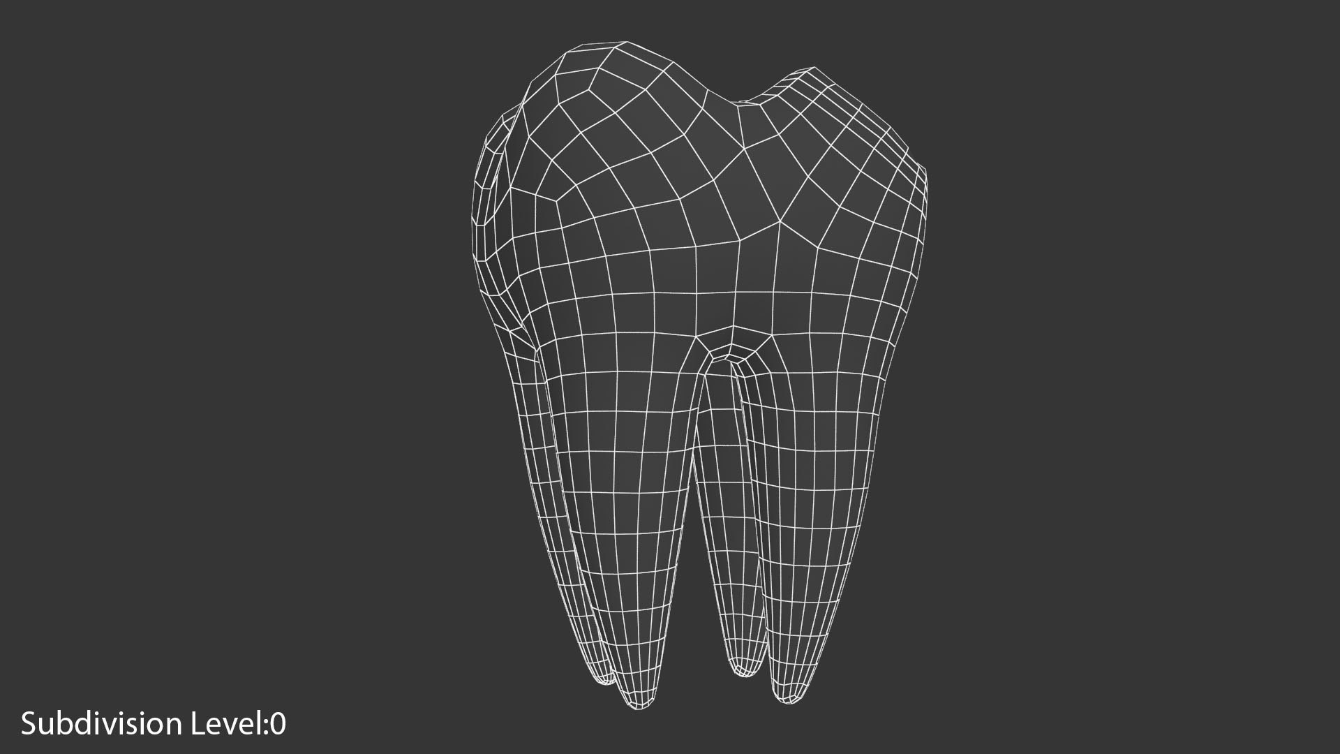 Teeth Decay 3D Model - TurboSquid 1438132