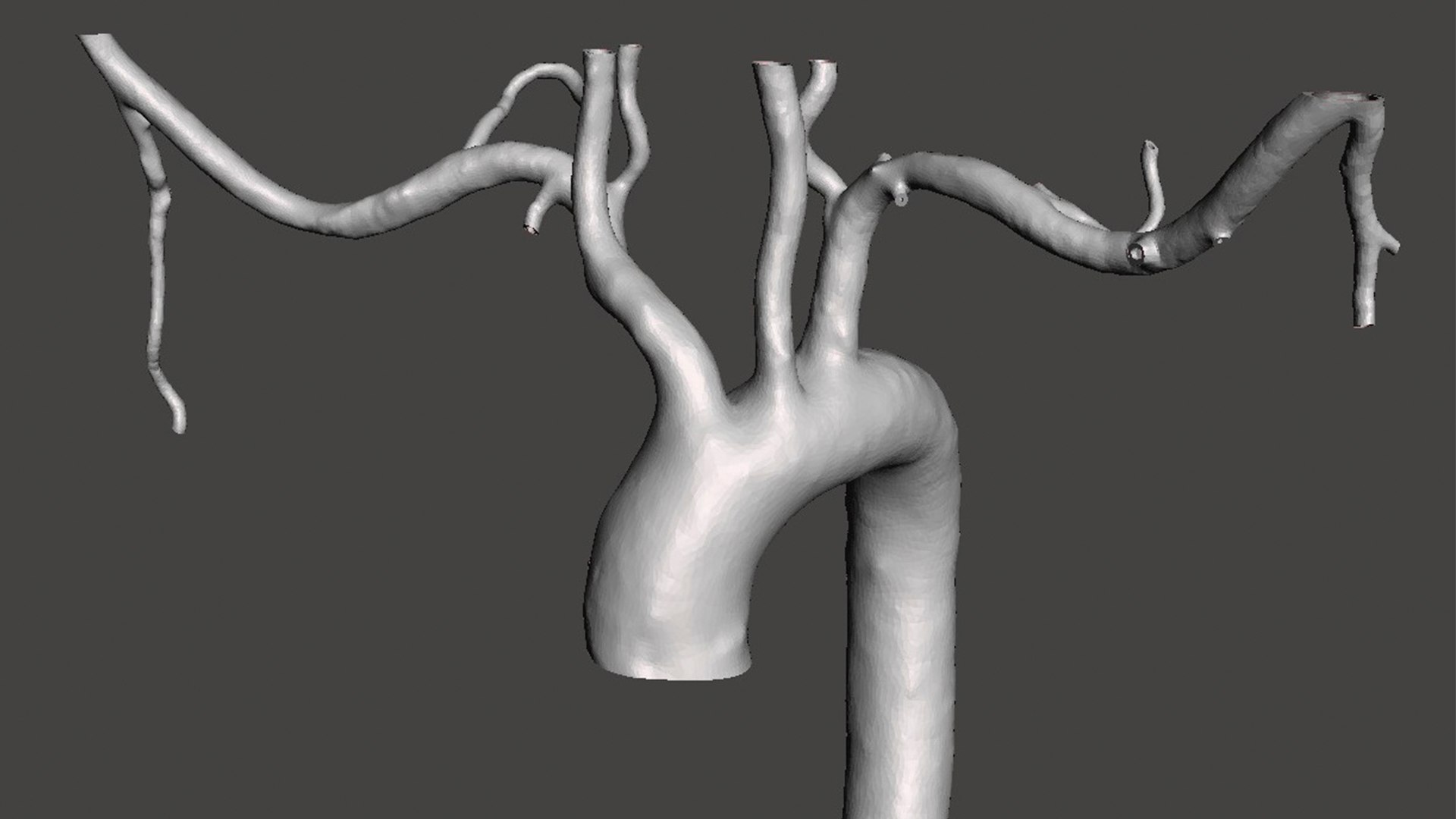 Aorta With Arteries 3D Model - TurboSquid 2125543