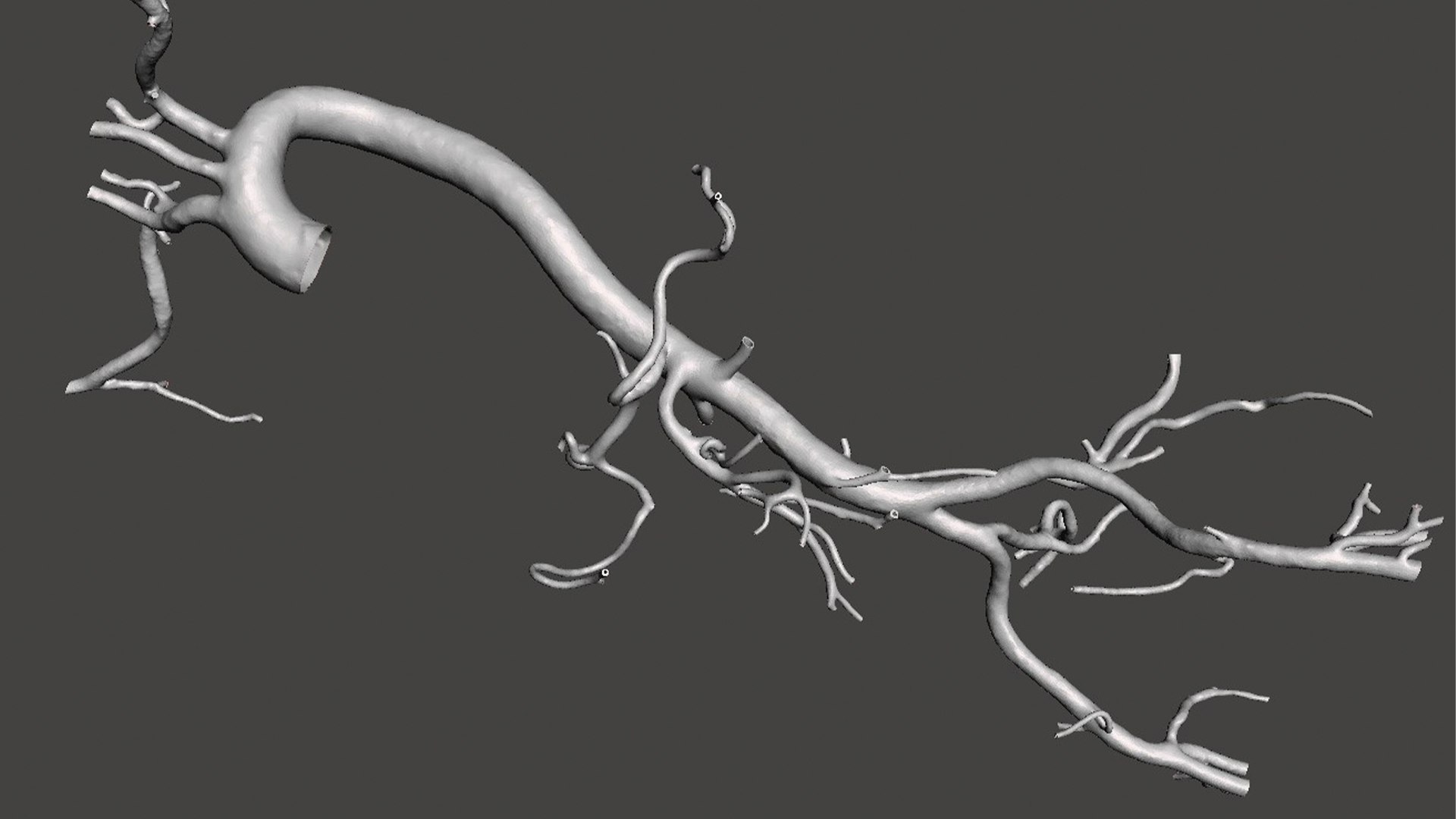 Aorta With Arteries 3D Model - TurboSquid 2125543