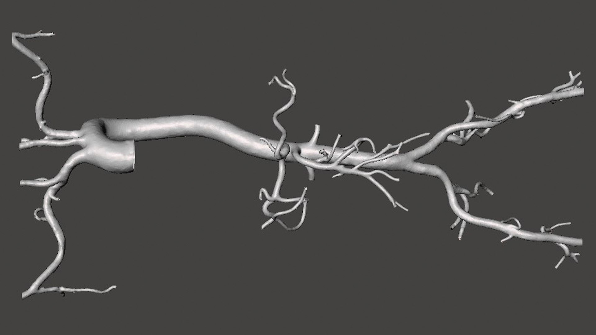 Aorta With Arteries 3D Model - TurboSquid 2125543