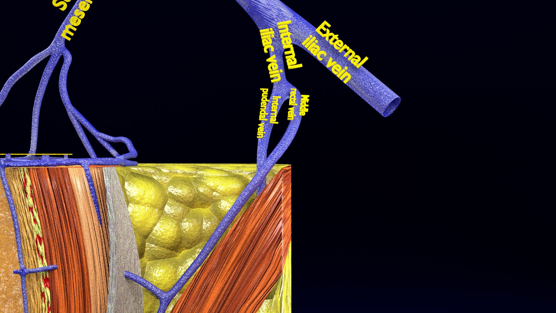 3D Hemorrhoids CLEANED UP Model - TurboSquid 1808970