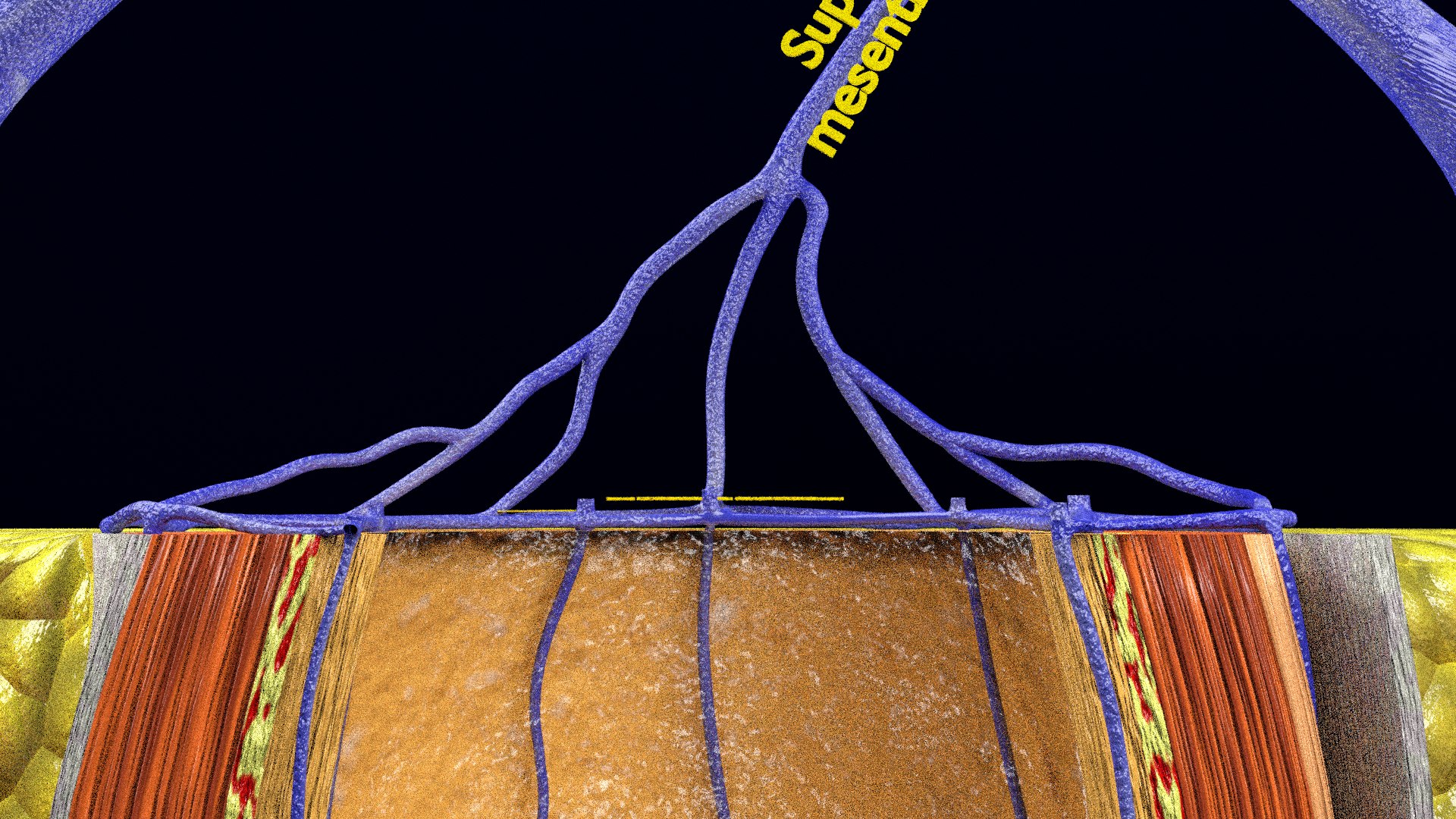 3D Hemorrhoids CLEANED UP Model - TurboSquid 1808970