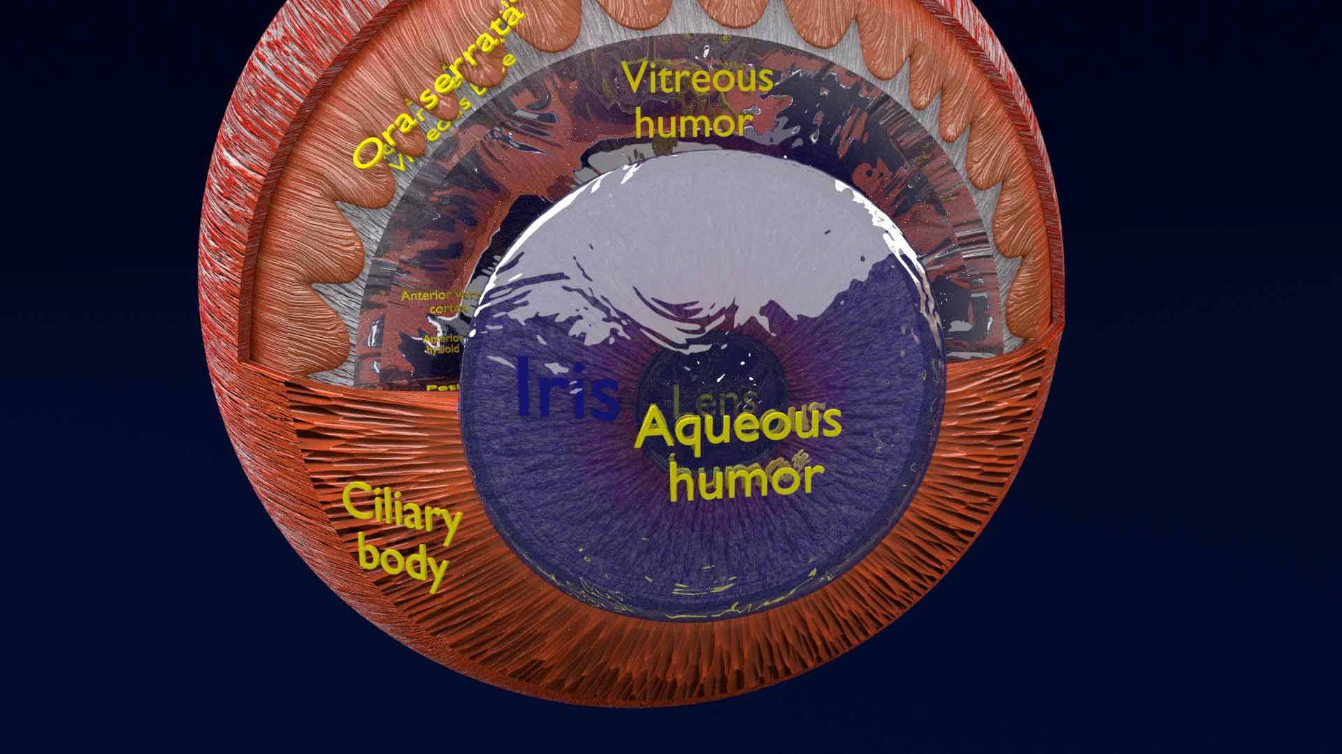 3D Model Posterior Vitreous Detachment Types Eye - TurboSquid 2031134