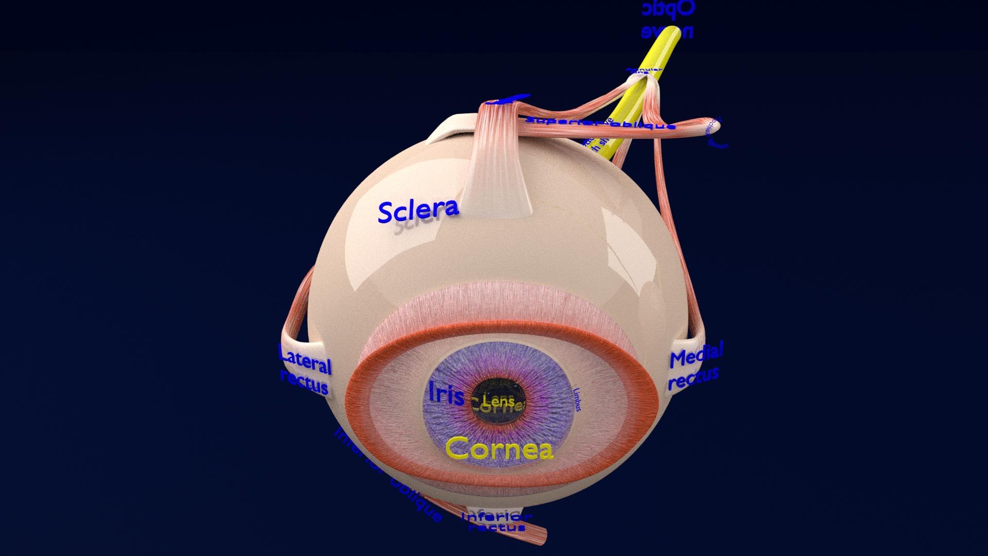 3D Model Posterior Vitreous Detachment Types Eye - TurboSquid 2031134